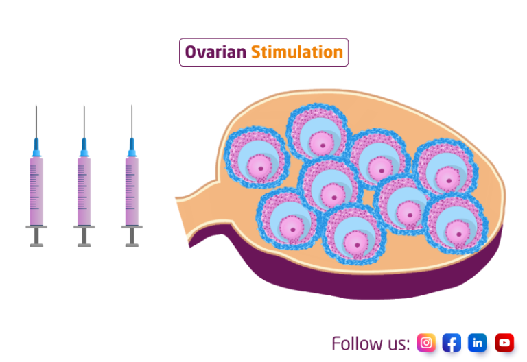 Best IVF Center in Maldives | best IVF treatment in Maldives